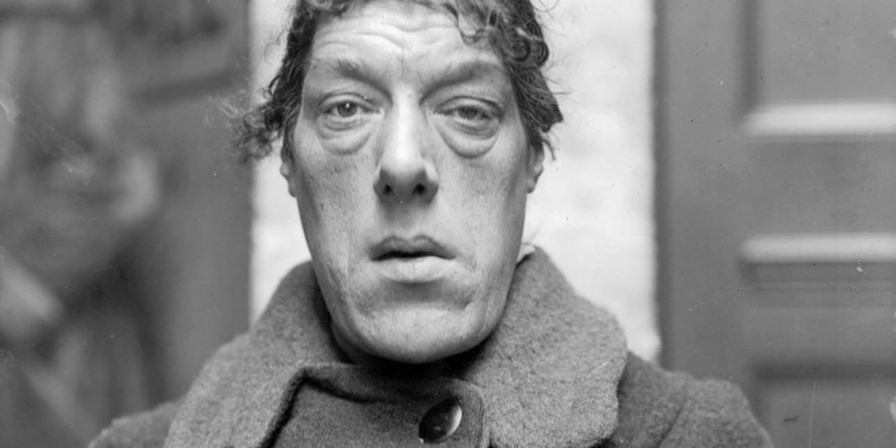 Η τραγική ιστορία της «πιο άσχημης γυναίκας του κόσμου» -Φτωχή μητέρα ...