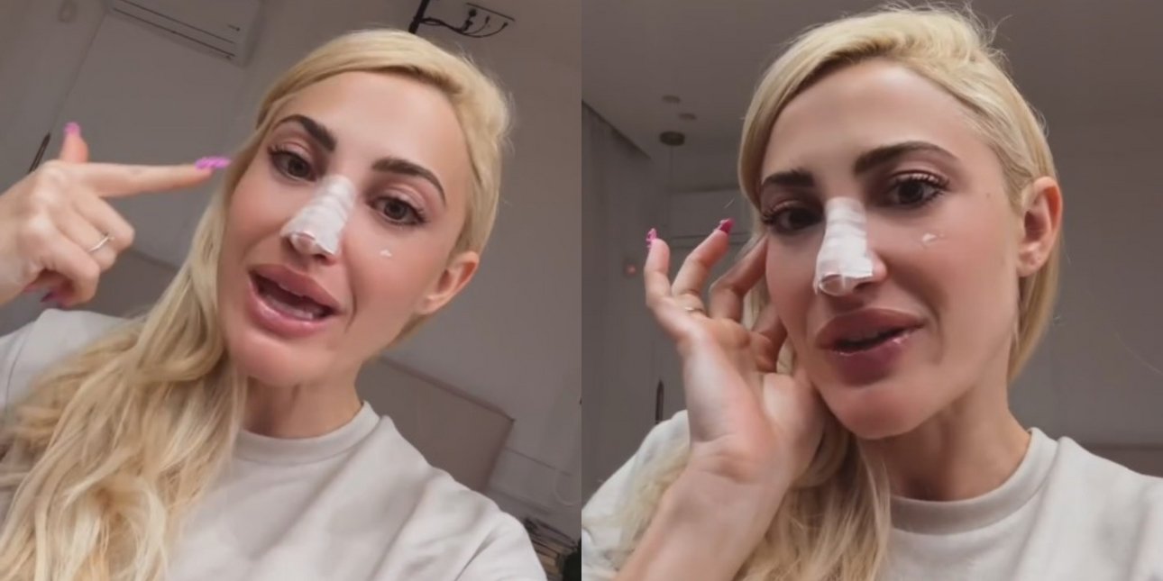 Ιωάννα Τούνη: Η απάντηση στα σχόλια για τη νέα μύτη της μετά την επέμβαση - iefimerida.gr