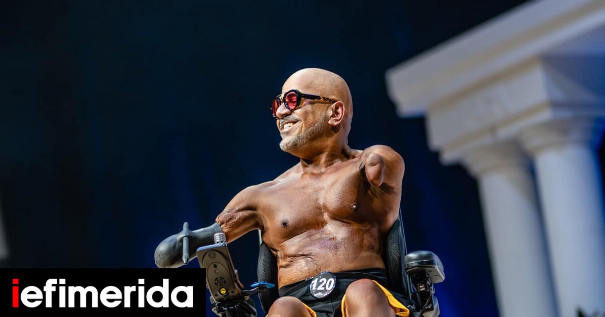 Μαθήματα ζωής από bodybuilder που έπαθε ηλεκτροπληξία 27.000V όταν ήταν παιδί - iefimerida.gr