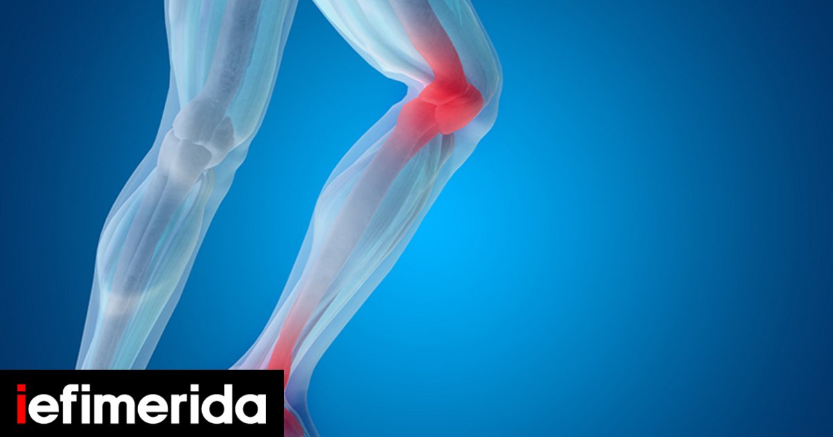 Παθήσεις αρθρικού χόνδρου: Νεότερες θεραπευτικές εξελίξεις - iefimerida.gr