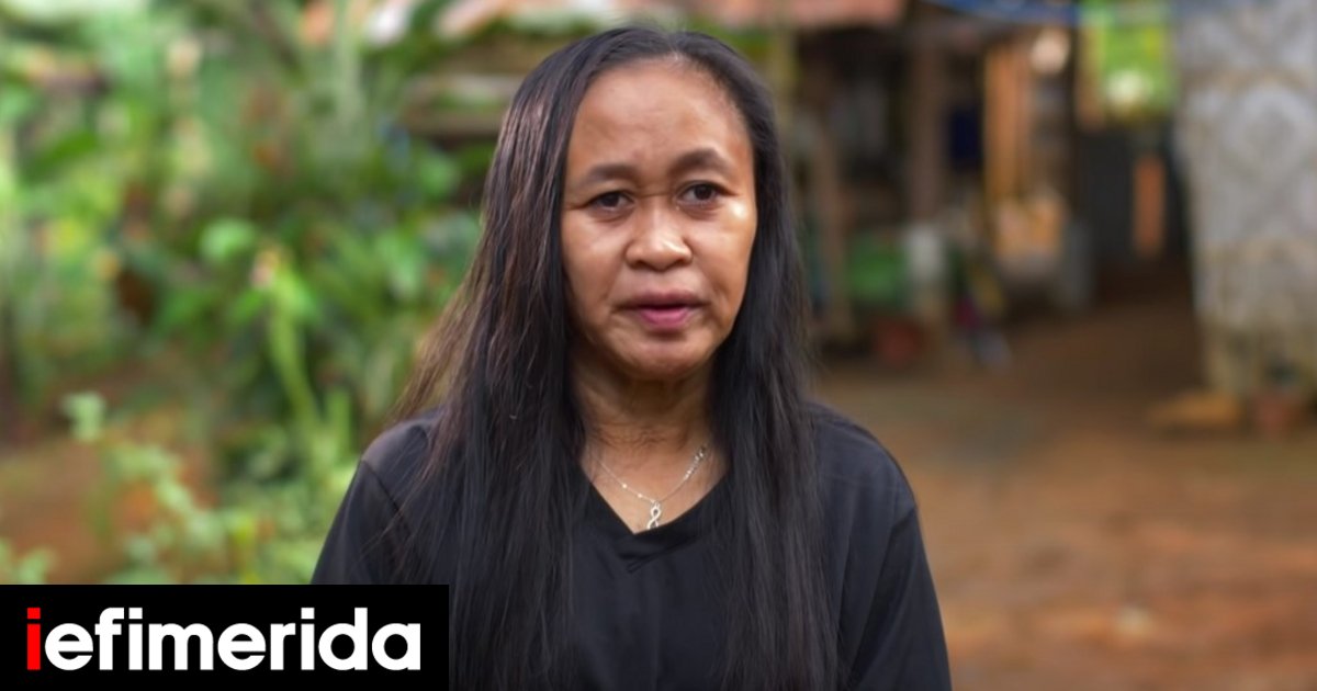 18χρονη «μοιάζει 50 ετών» λόγω σπάνιας πάθησης [βίντεο] - iefimerida.gr