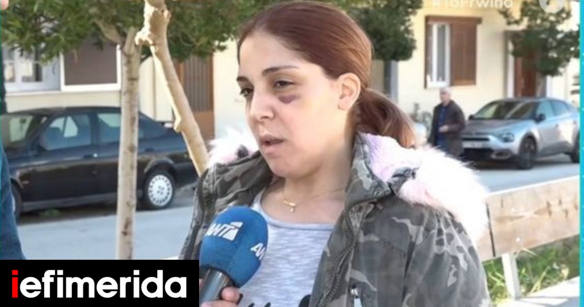 Άργος-Συγκλονίζει η 32χρονη: Αποκαλύπτει το γεμάτο σημάδια πρόσωπό της -Την απείλησε ότι θα ...