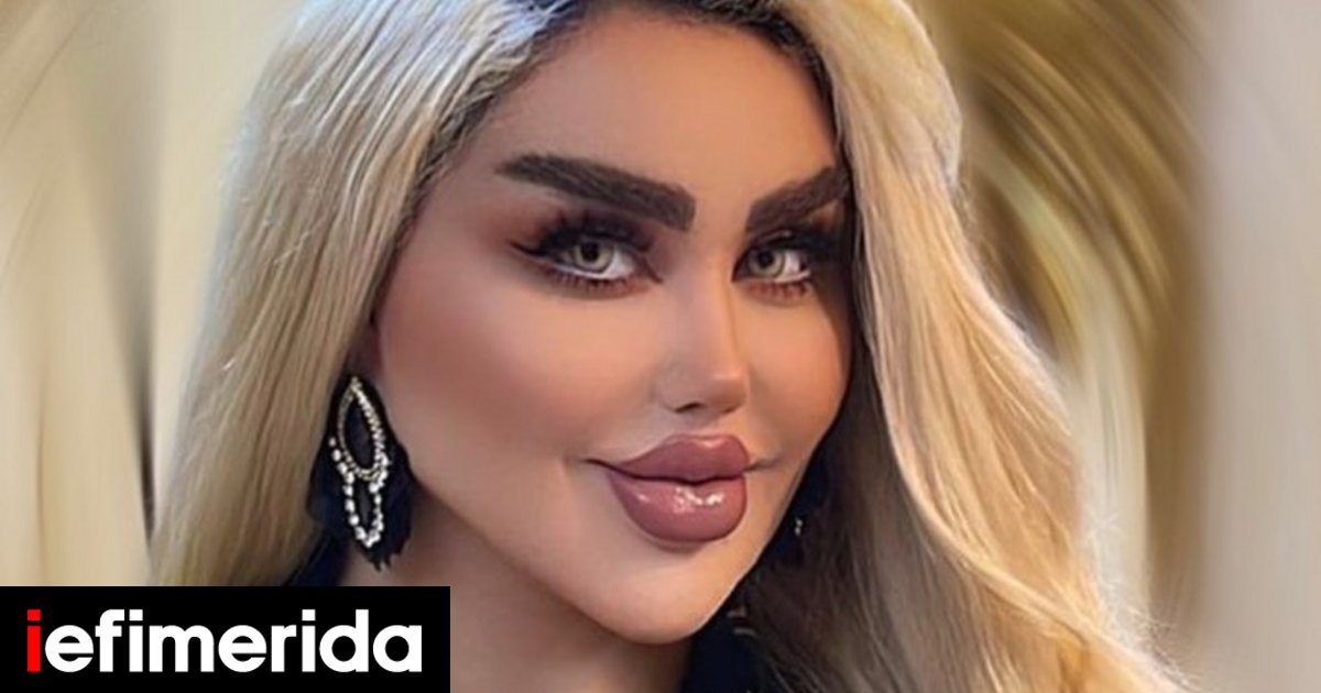 30χρονη έχει κάνει 43 πλαστικές επεμβάσεις για να μεταμορφωθεί σε Barbie -Βροχή τα σχόλια ...