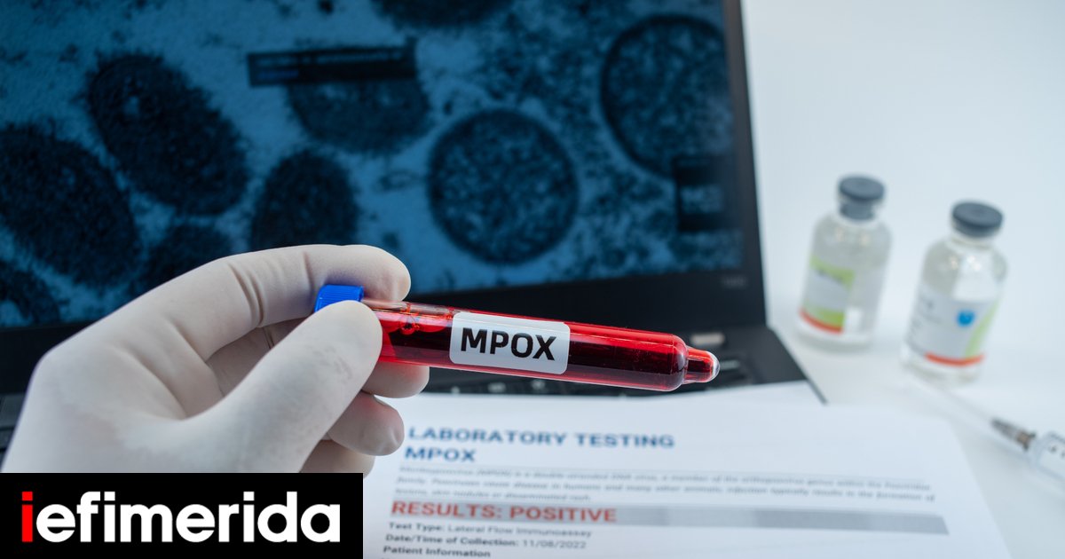 Συναγερμός στον ΕΟΔΥ: Επιβεβαιώθηκαν 18 κρούσματα mpox στη χώρα μας - iefimerida.gr