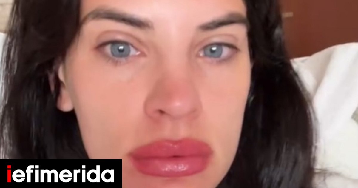 «Τα χείλη μου έχουν γίνει τριπλάσια. Καμία ιδέα;» έγραψε η Χριστίνα Μπόμπα ζητώντας συμβουλές ...