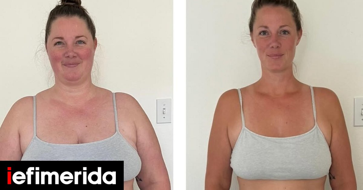 Πώς μια γυναίκα έχασε 45 κιλά με το Ozempic: Η απόφασή της να το σταματήσει και η υγιεινή ζωή ...