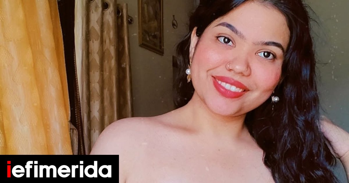 Έχασε 30 κιλά χωρίς γυμναστήριο: Δείτε πώς μεταμορφώθηκε το πρόσωπό της σε λίγες εβδομάδες -Το ...