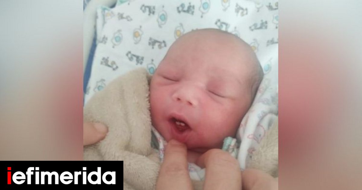 Μωρό γεννήθηκε με δύο δόντια σε νοσοκομείο στη Βραζιλία και τρόμαξε την οικογένειά του ...