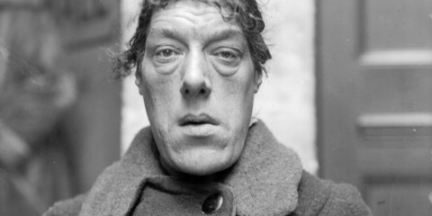 Η τραγική ιστορία της «πιο άσχημης γυναίκας του κόσμου» -Φτωχή μητέρα ...